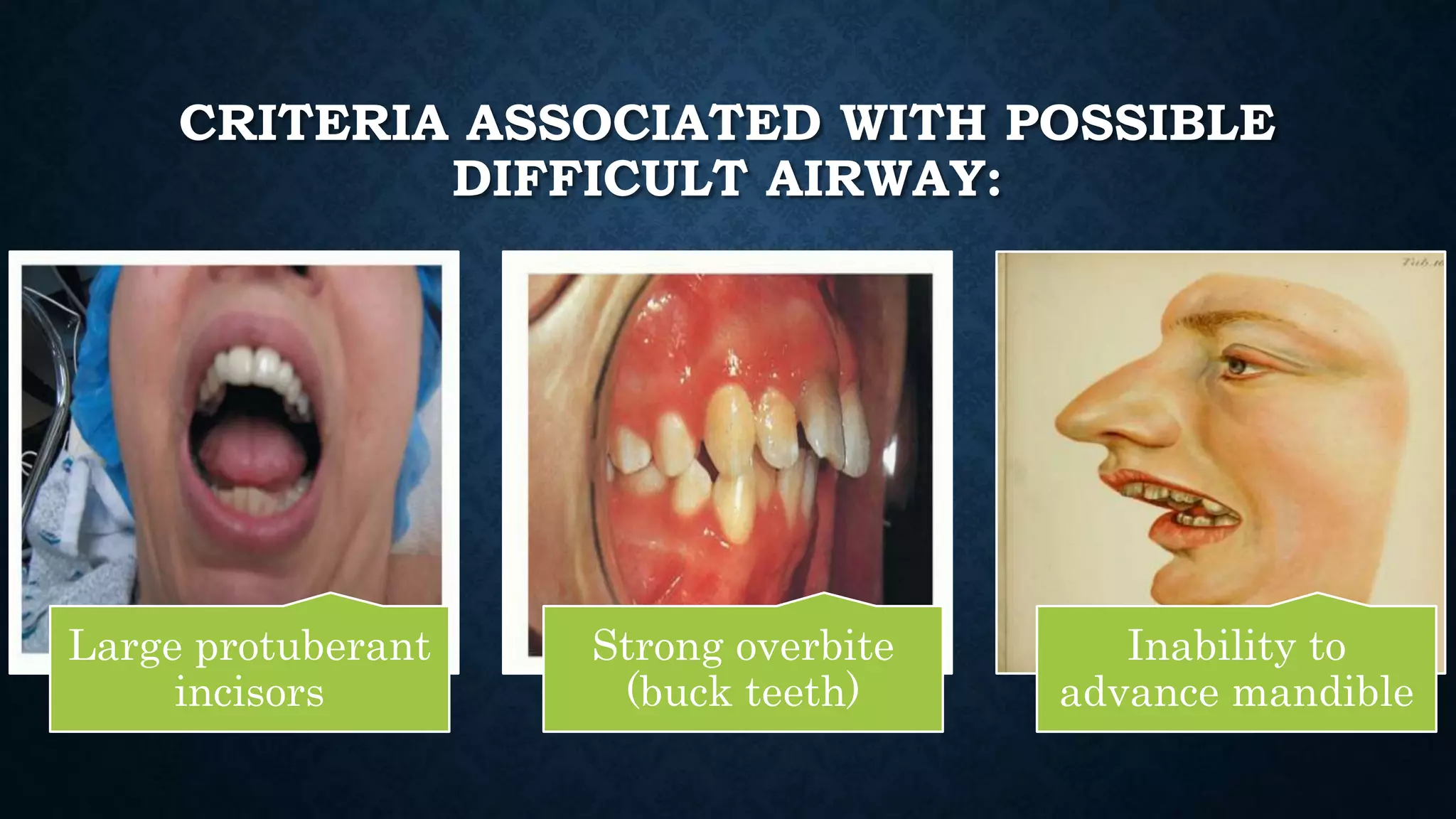 ANESTHESIA PREOPERATIVE EVALUATION.pptx