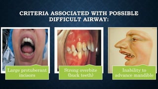 ANESTHESIA PREOPERATIVE EVALUATION.pptx