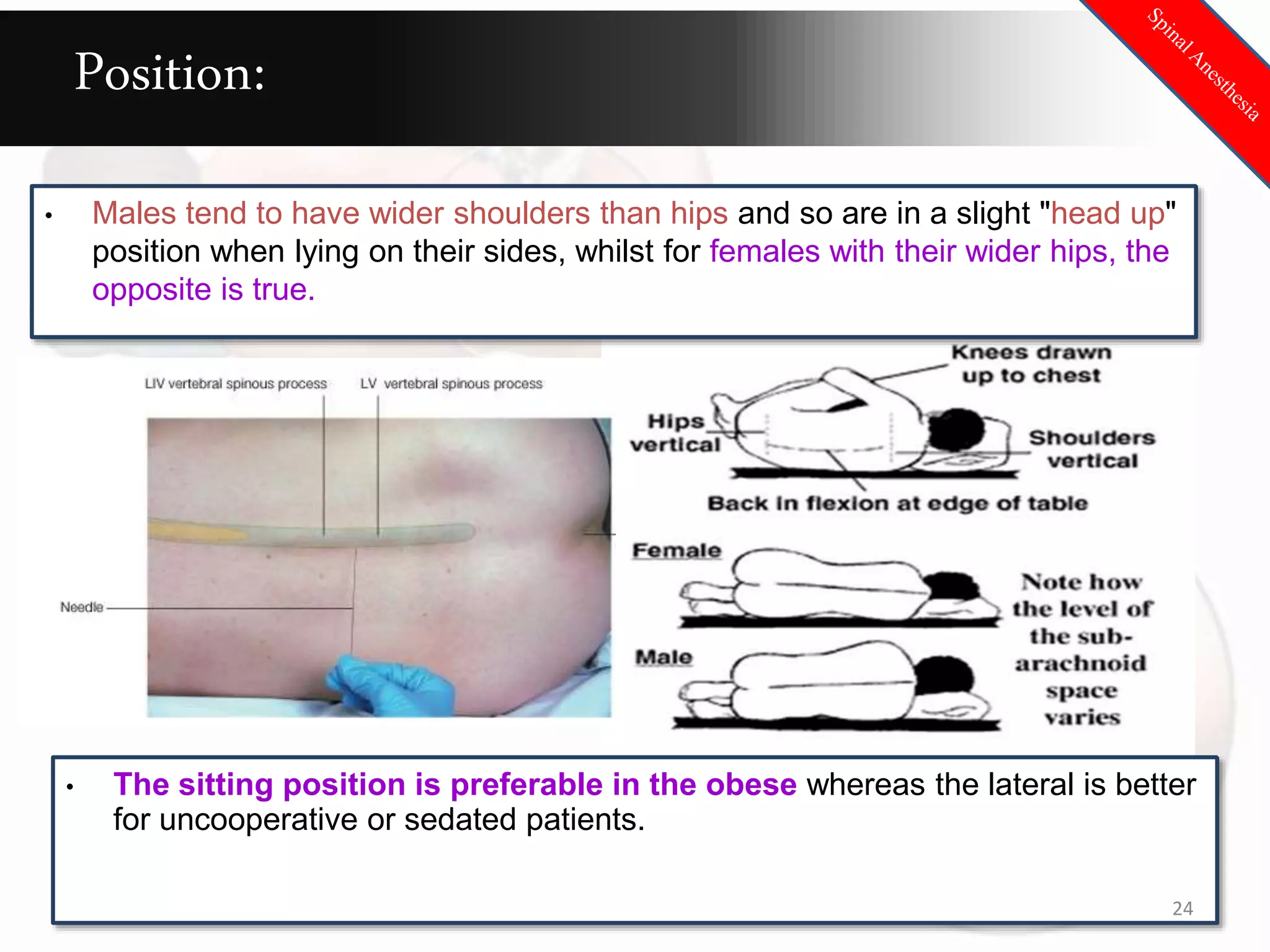 (Anesthesia) spinal anesthesia english by dr. kalimullah wardak | PPTX