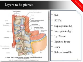 (Anesthesia) spinal anesthesia english by dr. kalimullah wardak | PPTX