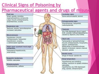 Anesthesia, Srishti Gupta acute poisoning.pptx
