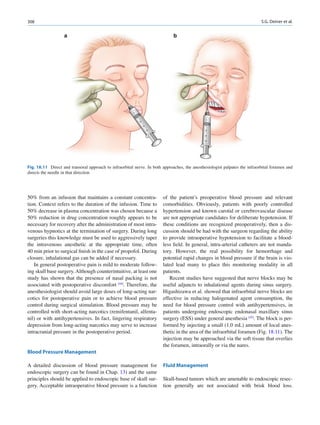 Anesthesiology and Otolaryngology | PDF