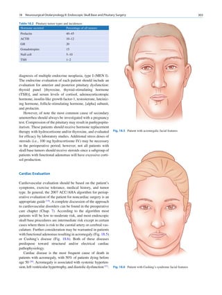 Anesthesiology and Otolaryngology | PDF
