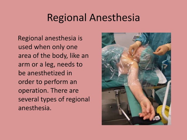 Types of Anesthesia | PPTX | Surgery | Medical Health