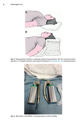 Anesthetic complications in pregnancy | PDF