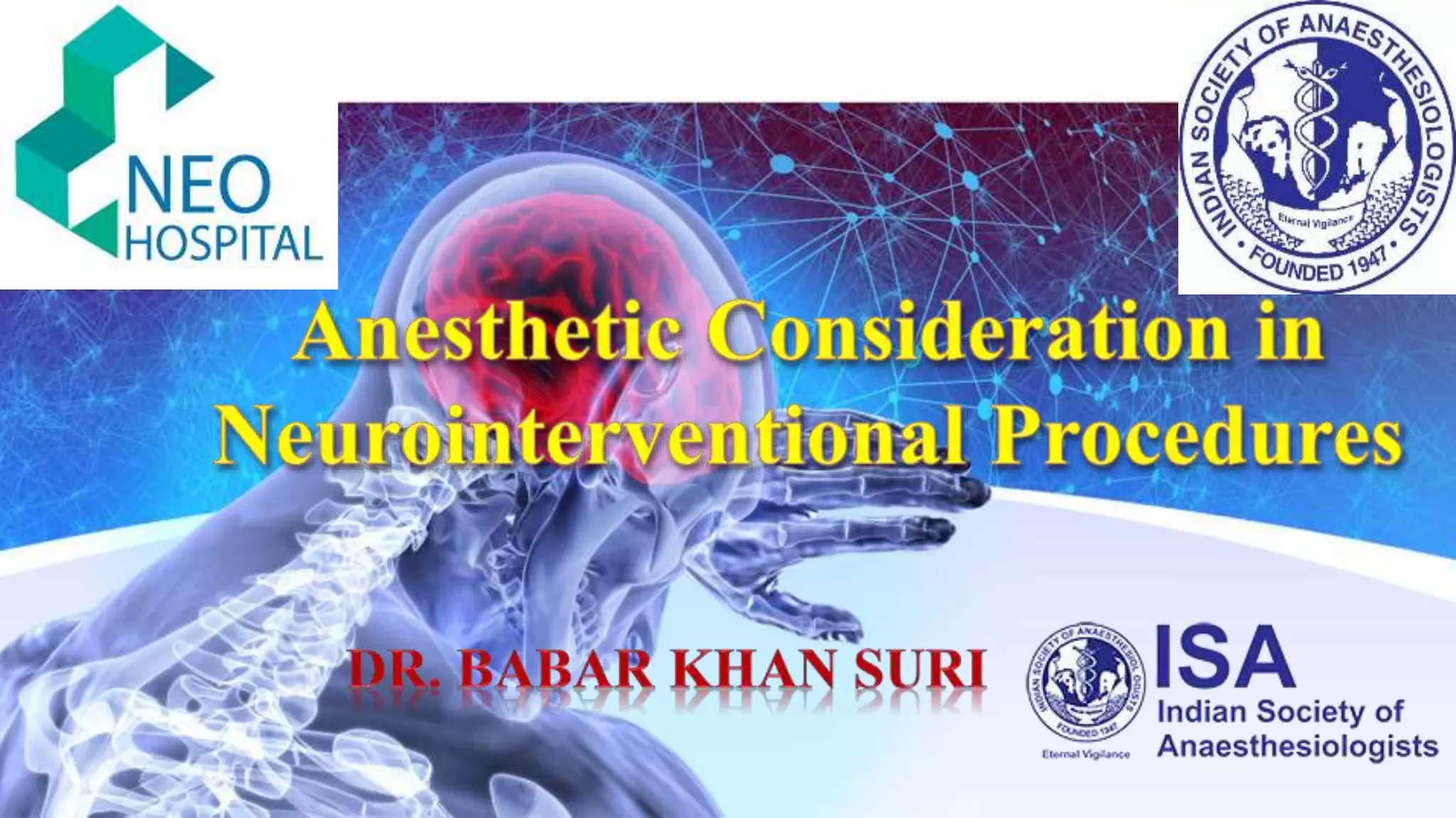 Anesthetic Consideration in neuro interventional procedure.pptx | Brain ...