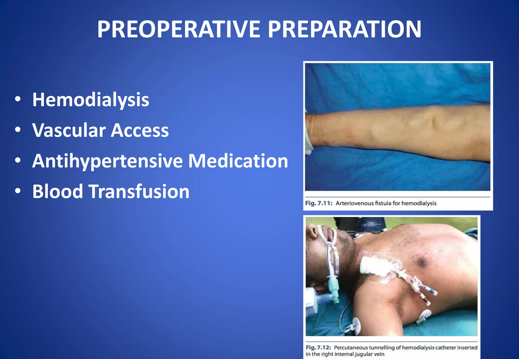 Anesthetic considerations for kidney transplant in an adult | PPTX