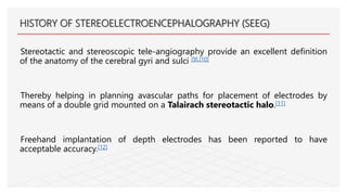 ANESTHETIC CONSIDERATIONS FOR STEREOTACTIC ELECTROENCEPHALOGRAPHY (SEEG ...