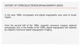 ANESTHETIC CONSIDERATIONS FOR STEREOTACTIC ELECTROENCEPHALOGRAPHY (SEEG ...