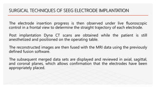 ANESTHETIC CONSIDERATIONS FOR STEREOTACTIC ELECTROENCEPHALOGRAPHY (SEEG ...