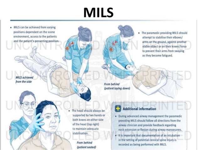 Anesthetic management of facio maxillary trauma