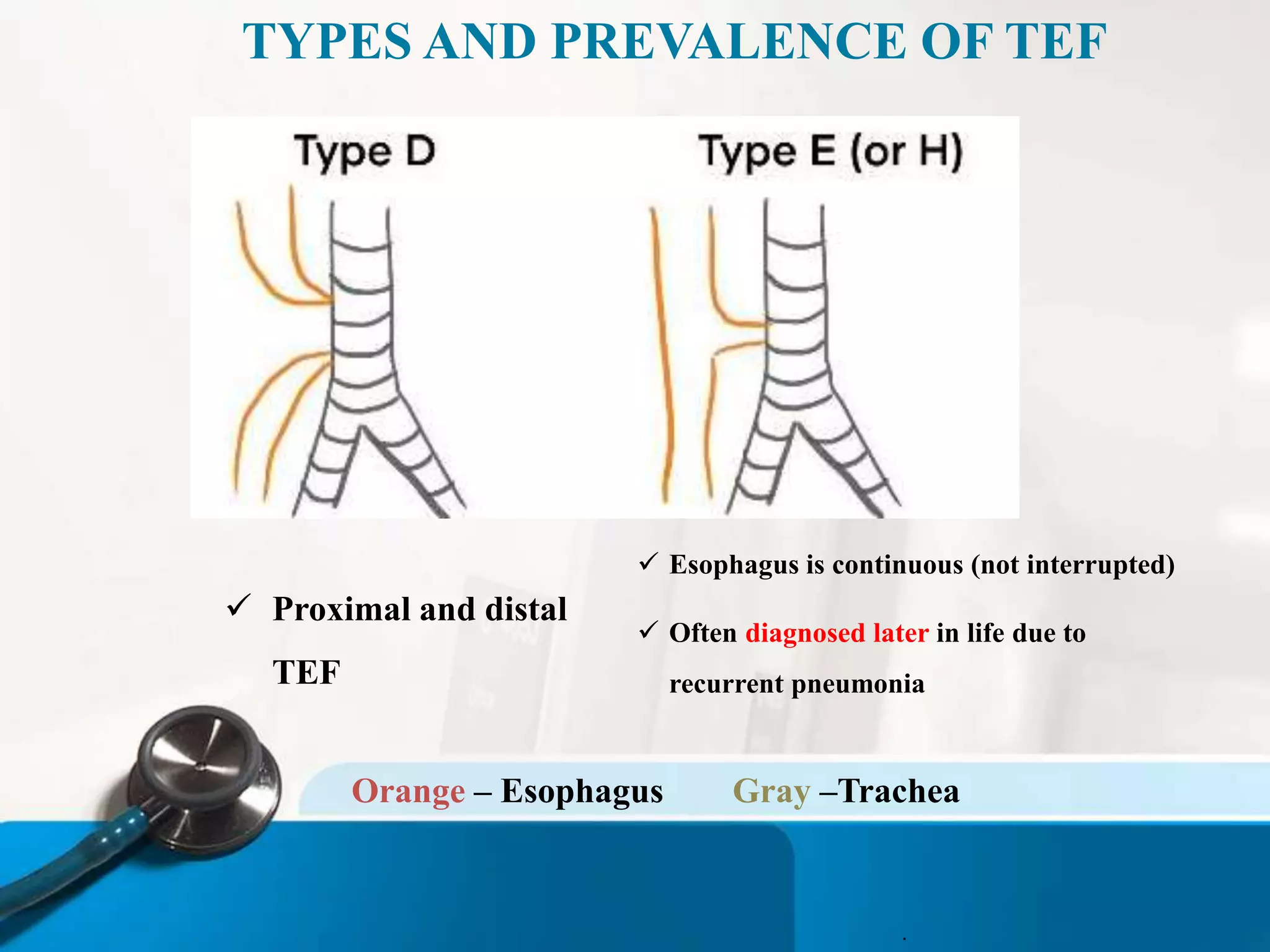ANESTHETIC MANAGEMENT OF TRACHEOESOPHAGEAL FISTULA by Dr.Sravani ...