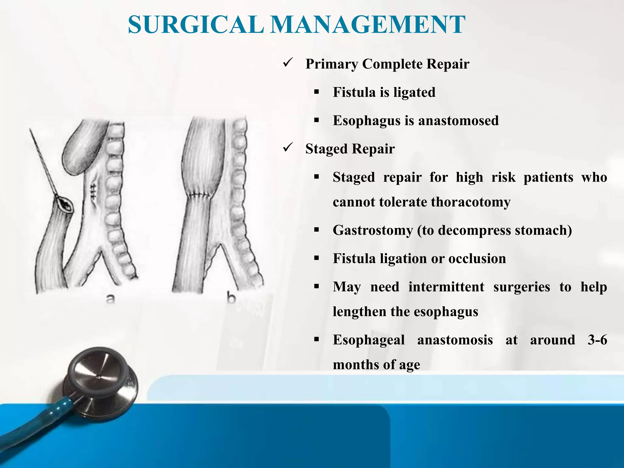 ANESTHETIC MANAGEMENT OF TRACHEOESOPHAGEAL FISTULA by Dr.Sravani ...