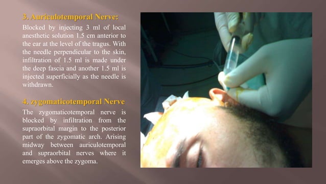 Awake Craniotomy | PPTX | Brain and Nervous System Disorders | Diseases ...