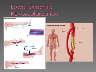 Trauma & Burns | PPT