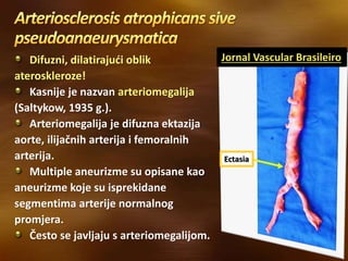 Aneurizme arterija | PPSX
