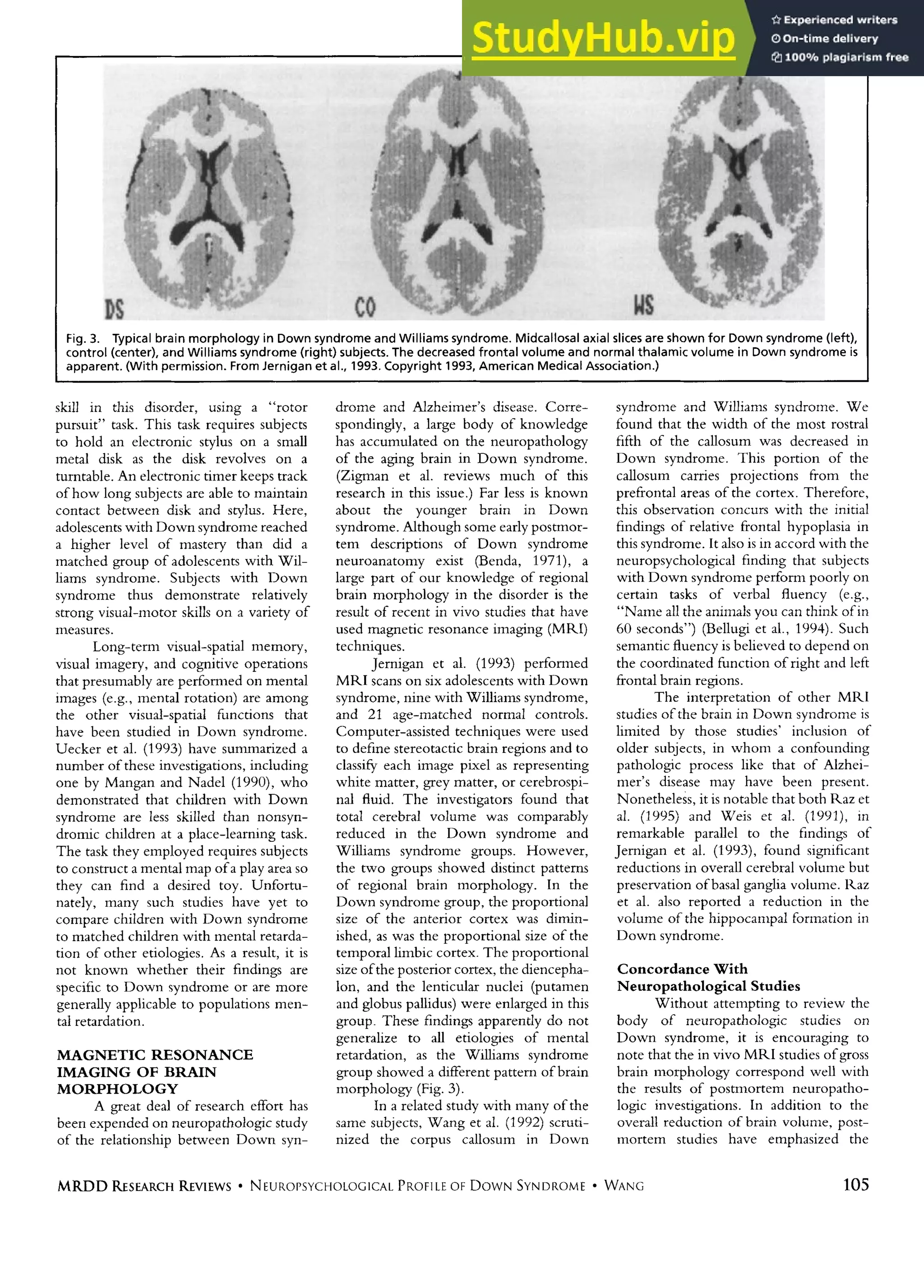 A neuropsychological profile of Down syndrome Cognitive skills and ...