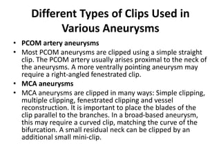 Aneursym Clips.pptx
