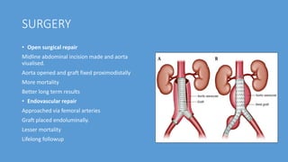 ANEURYMS AND VASCULITIS stanley medical college | PPT