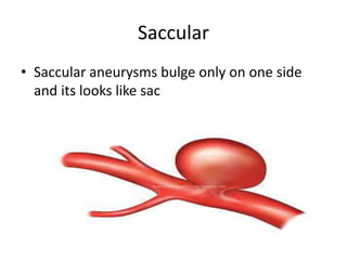 Aneurysm | PPTX | Heart and Cardiovascular Diseases | Diseases and ...