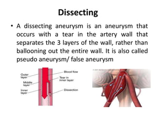 Aneurysm | PPTX