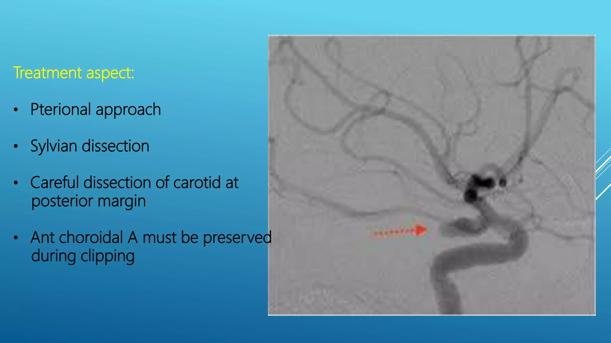 Anterior circulation Aneurysm | PPTX