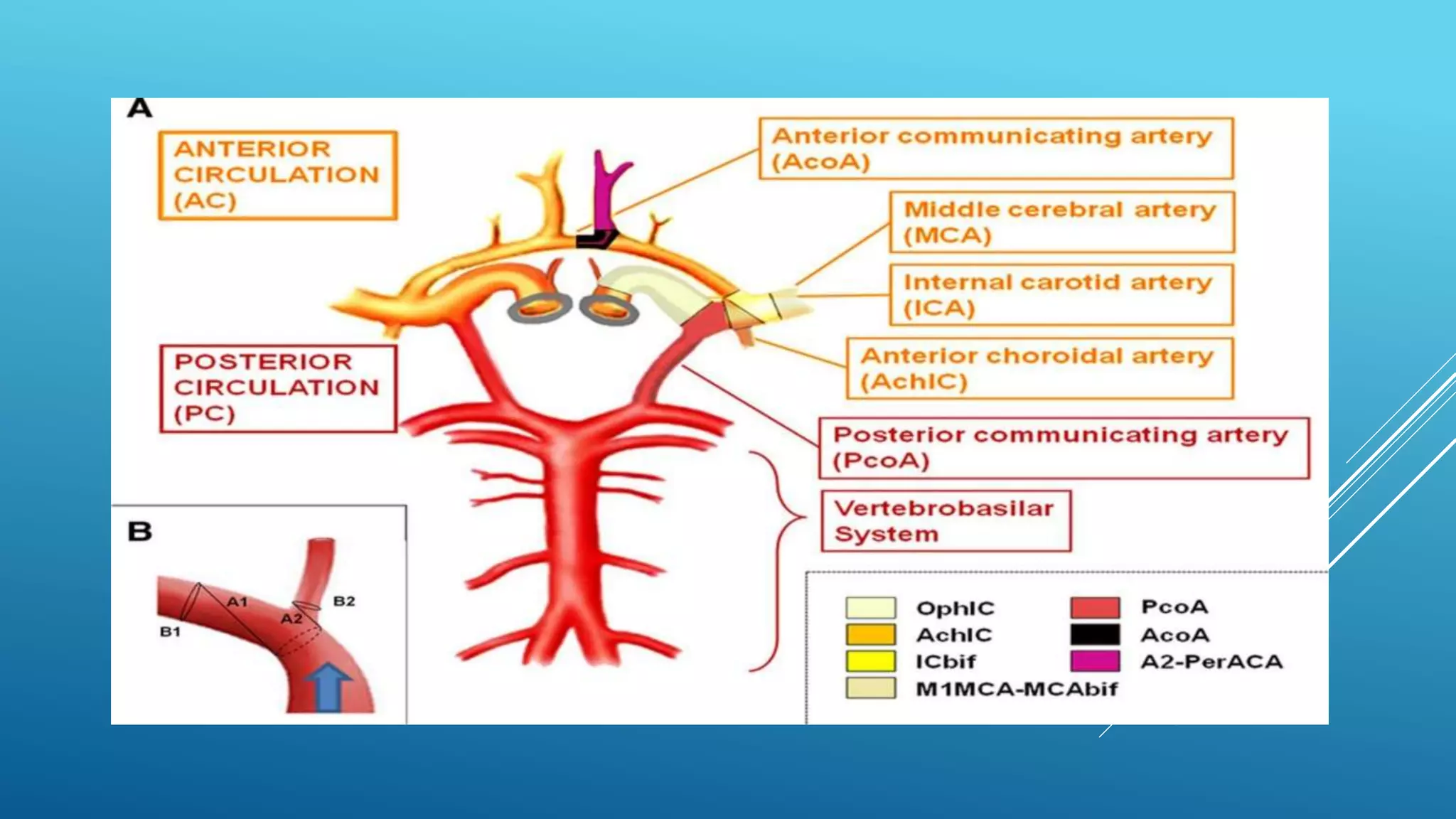 Anterior circulation Aneurysm | PPTX