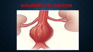 aneurysm-210530112039.pdf