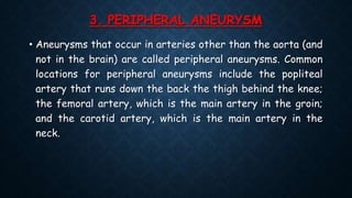 Aneurysm | PPTX