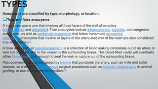 Aneurysm | PPTX
