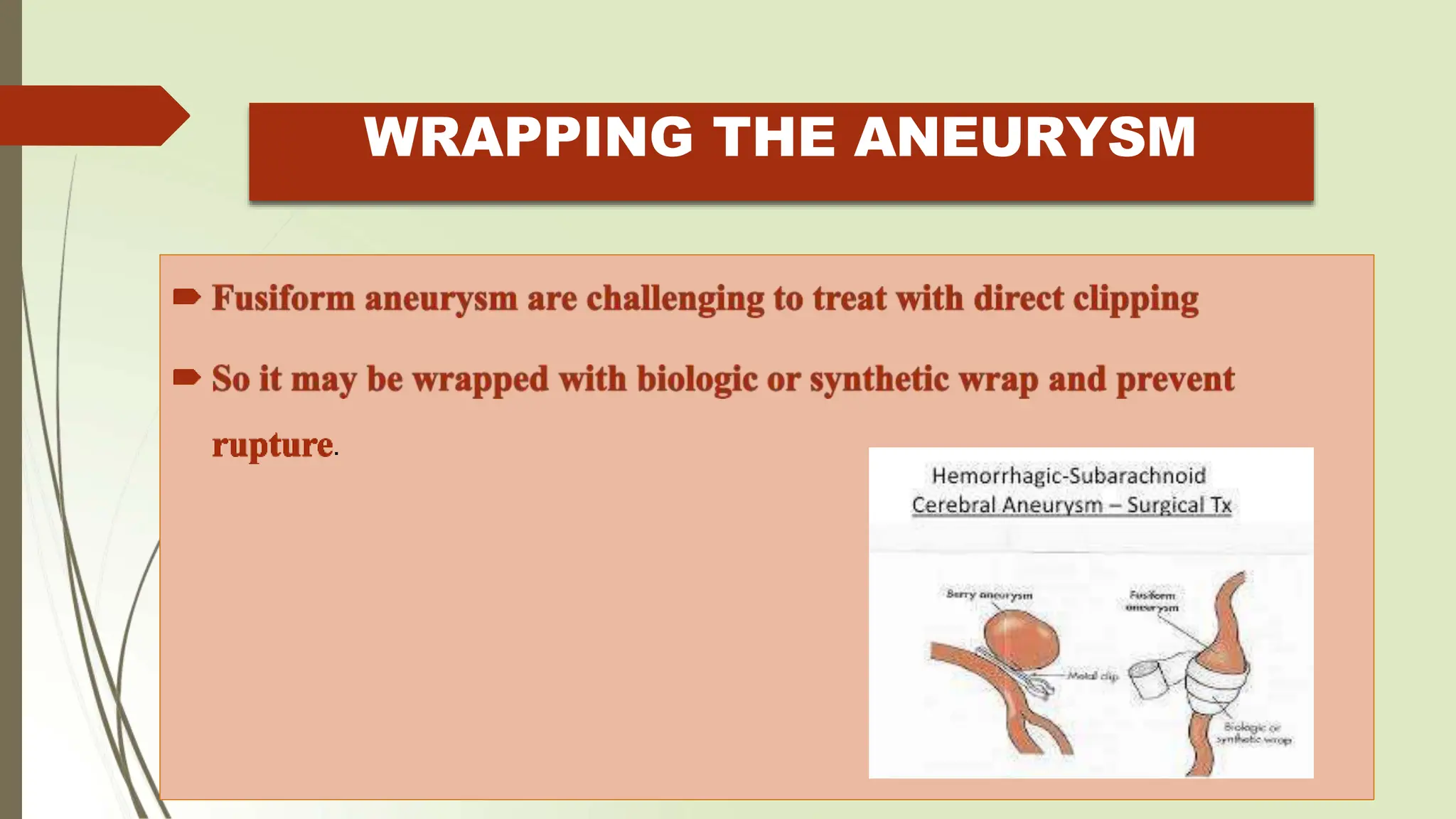 Aneurysmclassification-aortic aneurysm.pptx | Heart and Cardiovascular ...