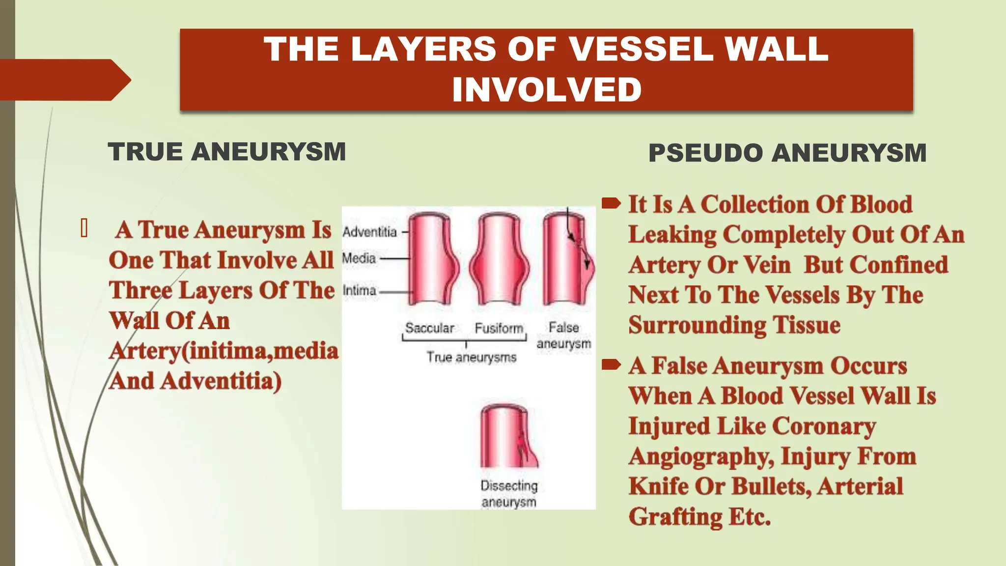 Aneurysmclassification-aortic aneurysm.pptx | Heart and Cardiovascular ...