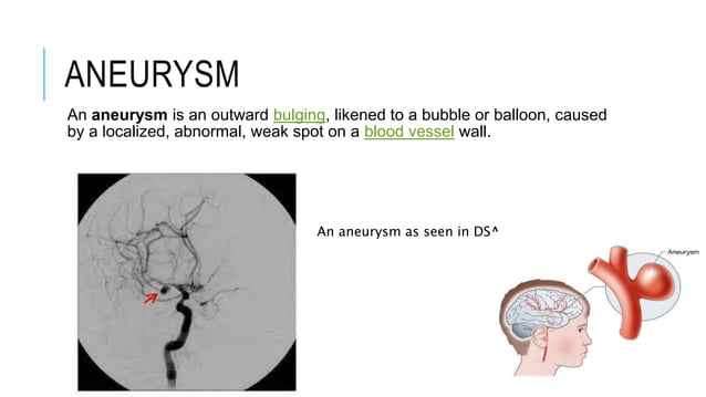nursing care of patients with aneurysm.pptx | First Aid | Injuries