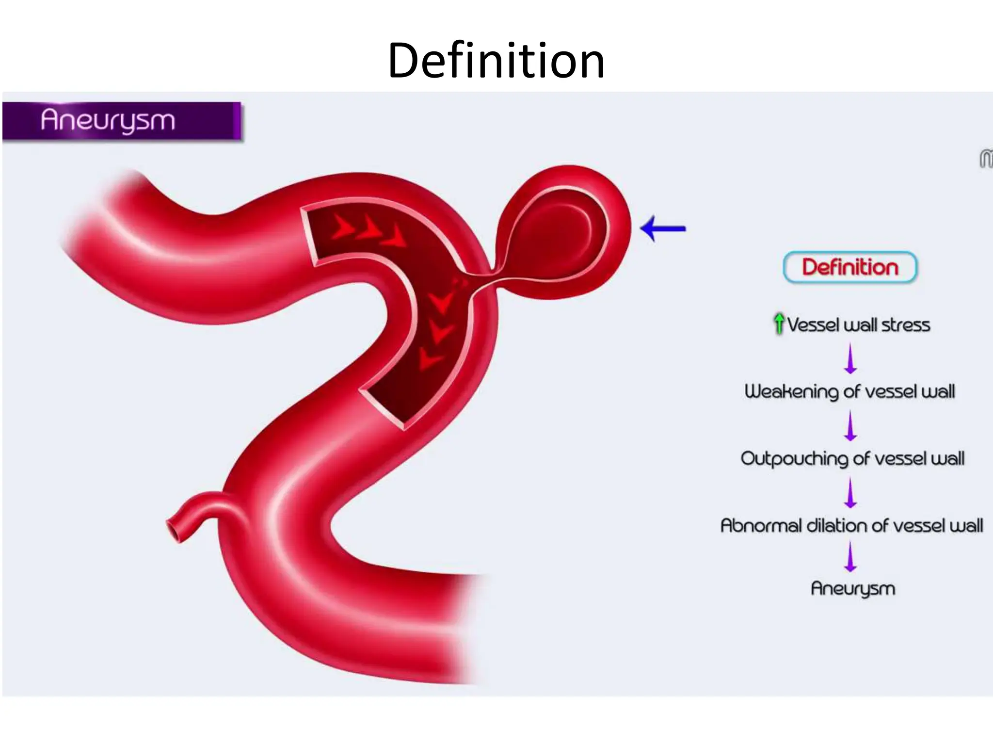 aneurysm pathology pptx from.robbins sss | PPT