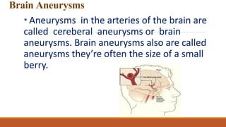 aneurysm.pdf for nursing students for medical surgical nursing students | PPT