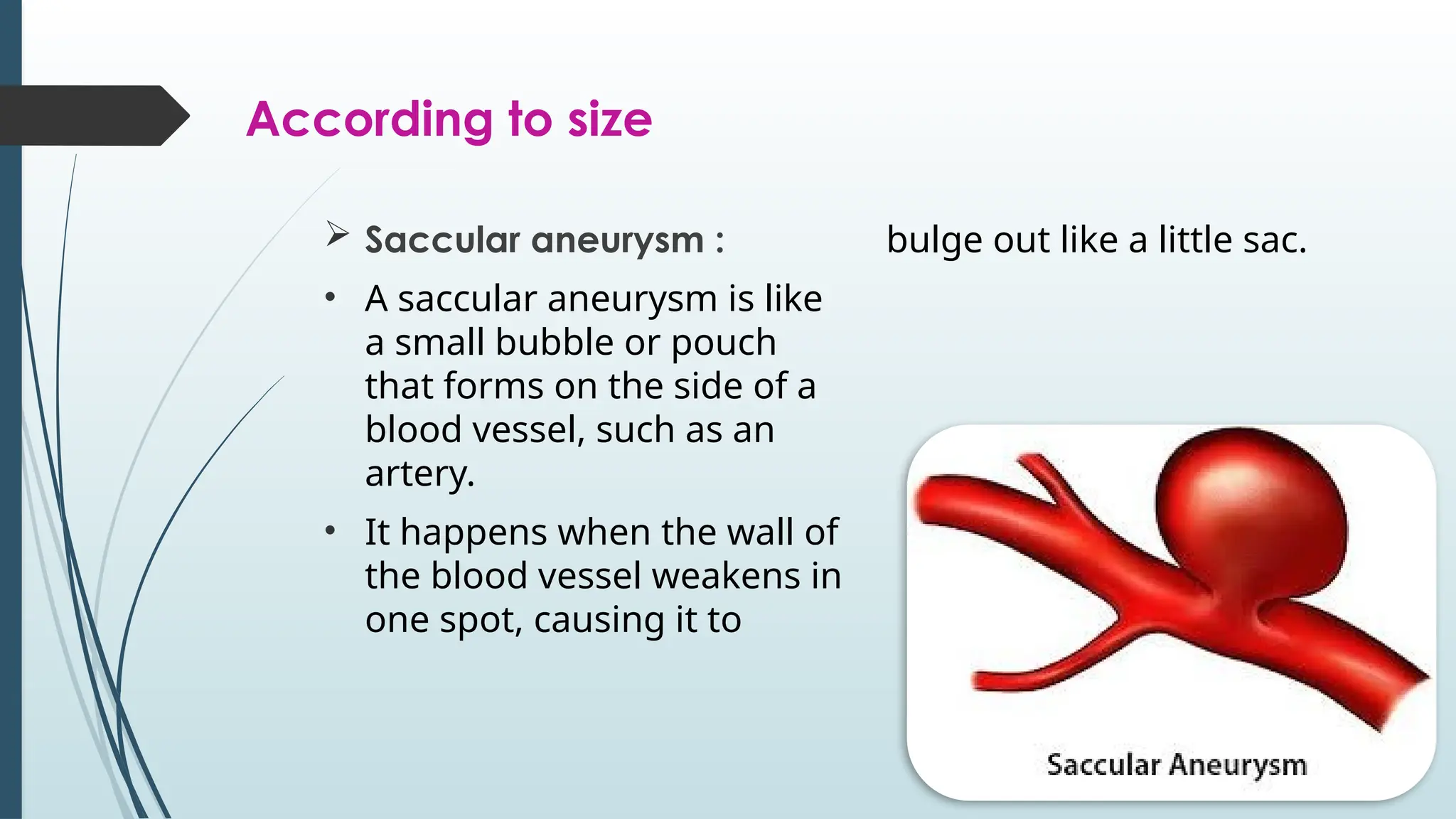 Aneurysm , classification of aneurysm and causes of aortic aneurysm | PPTX
