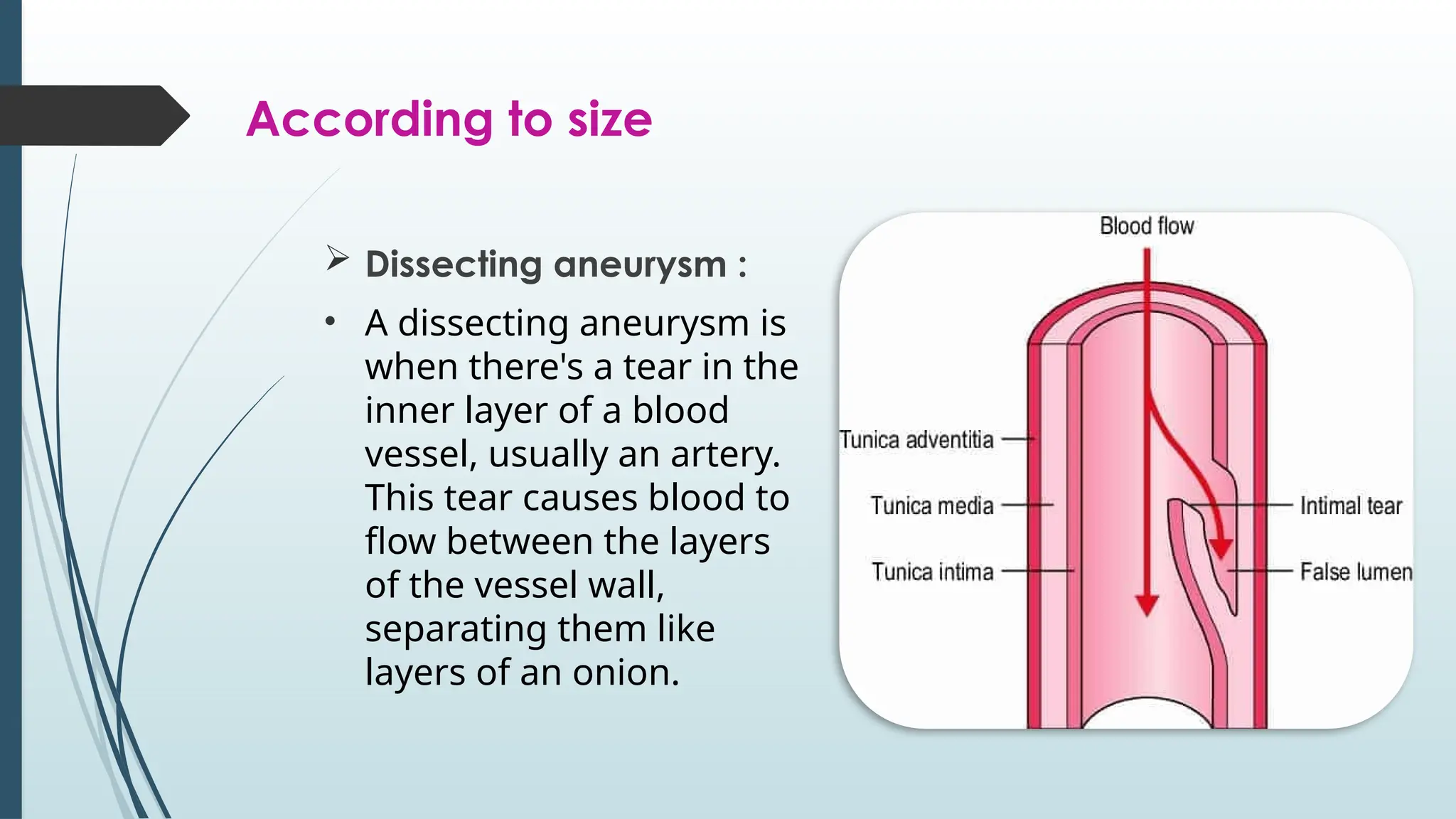 Aneurysm , classification of aneurysm and causes of aortic aneurysm | PPTX