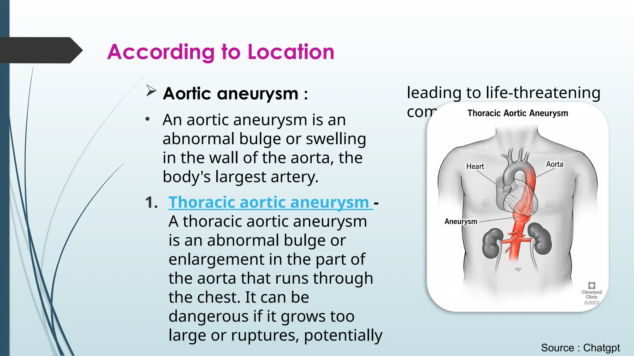 Aneurysm , classification of aneurysm and causes of aortic aneurysm | PPTX