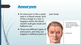 Aneurysm , classification of aneurysm and causes of aortic aneurysm | PPT
