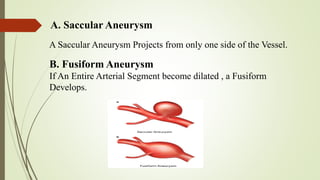 Aneurysm popliteal aneurysm is an abnormal bulging or swelling in the ...