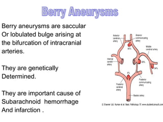 Aneurysm by dr.majid nawaz | PPT