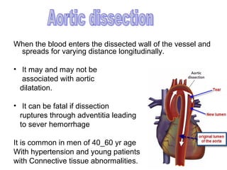 Aneurysm by dr.majid nawaz | PPT