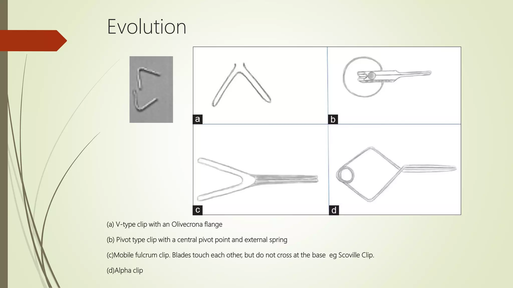 Aneurysm clips /clipology | PPTX