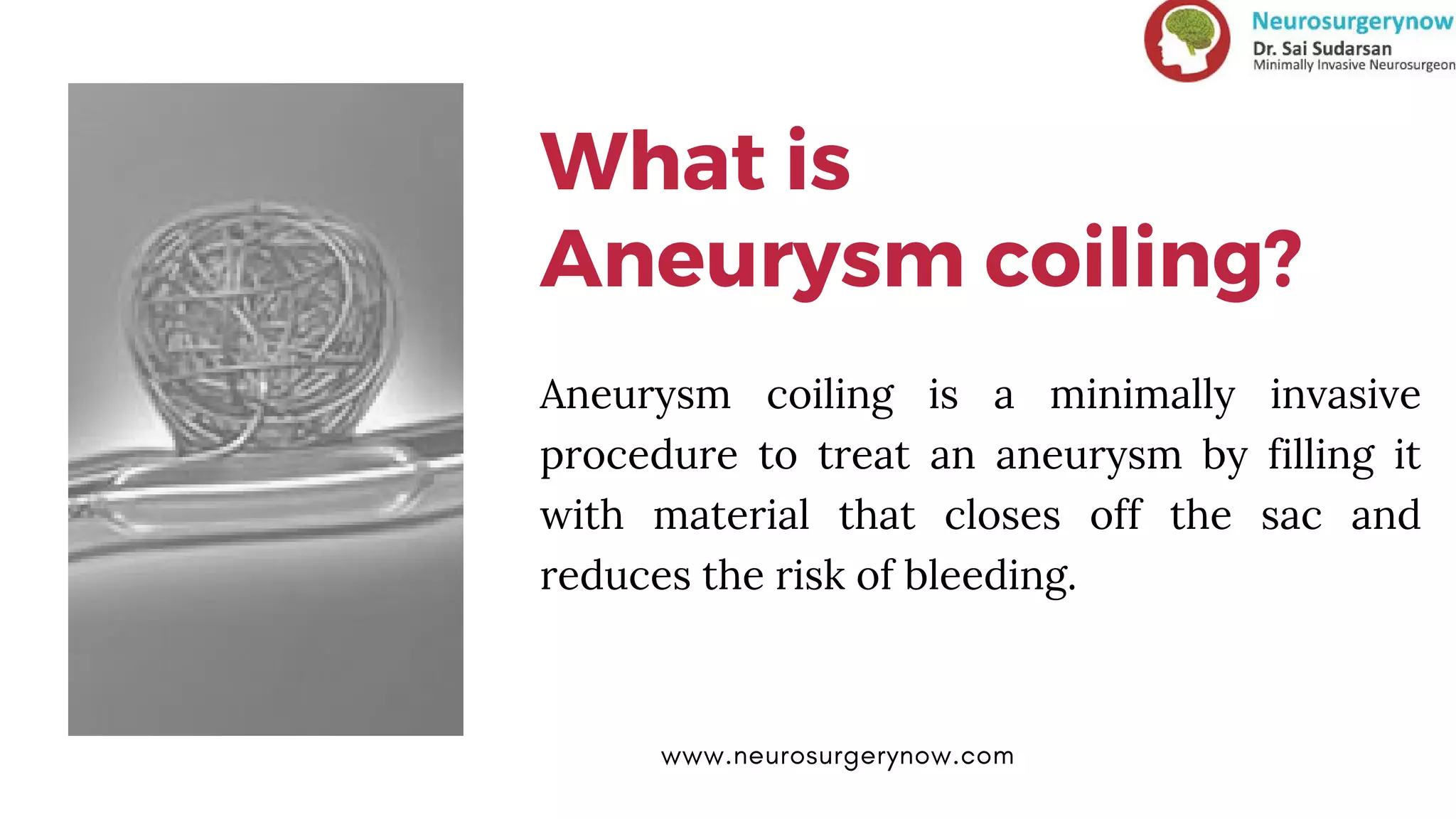 Aneurysm coiling | PDF
