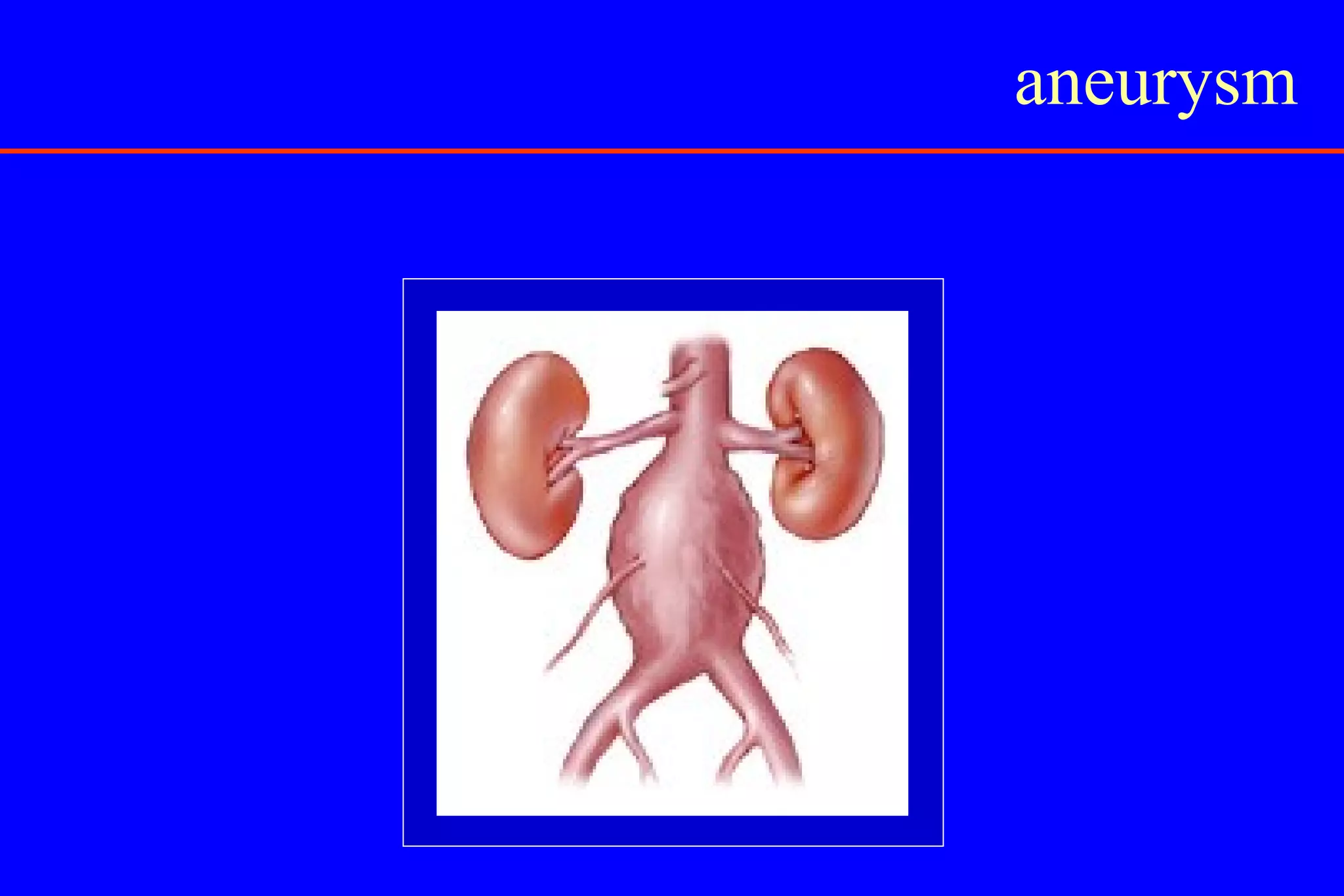Abdominal Aortic Aneurysm | PPT