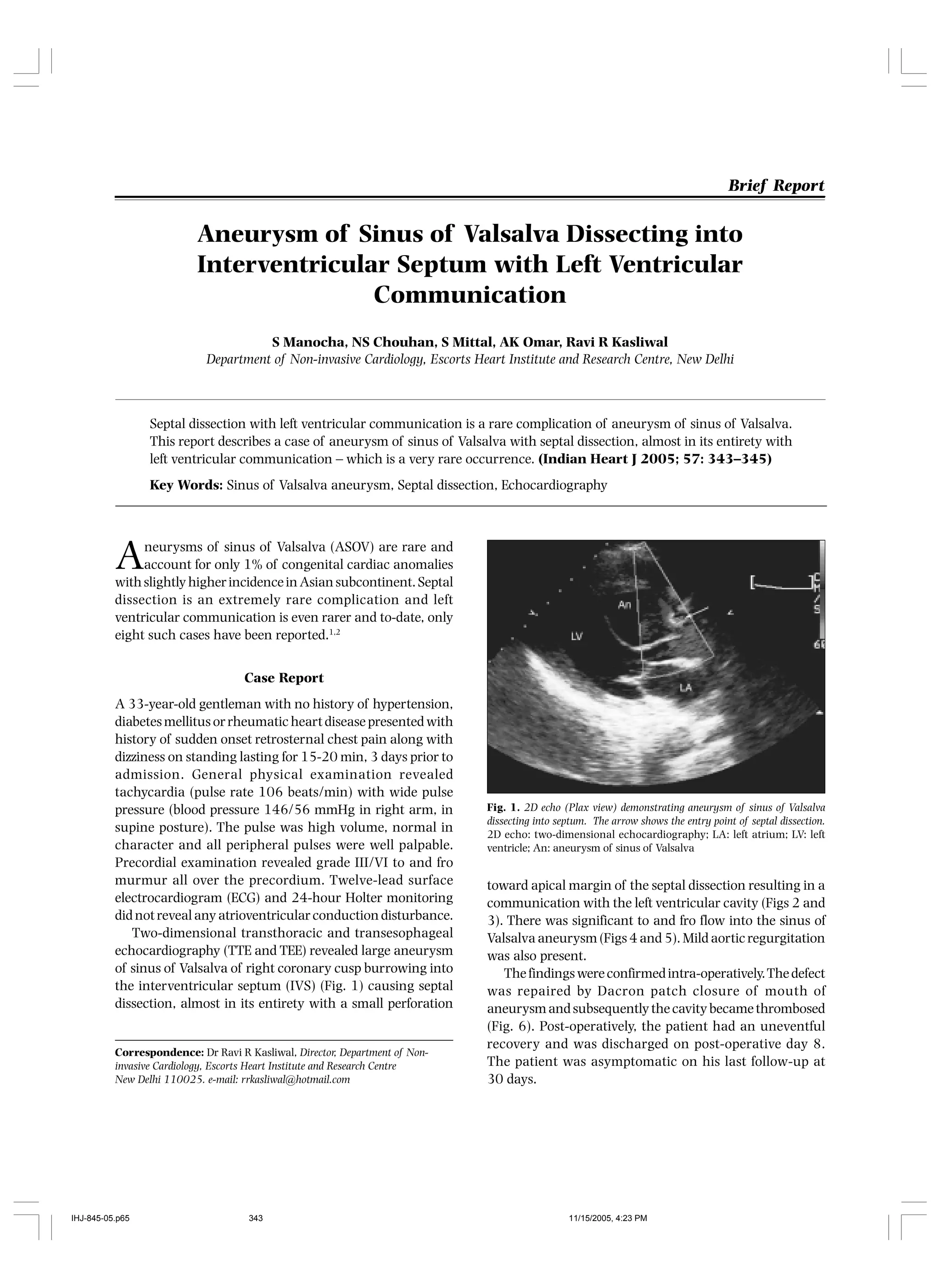 Aneurysm of sinus of valsalva | PDF