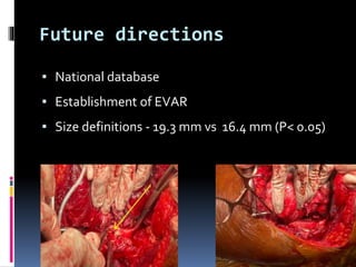 Aneurysm repair Open vs EVAR SLSVS.ppt