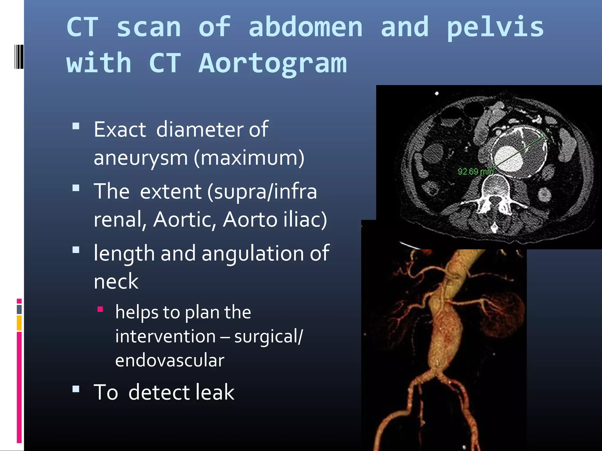 Aneurysms | PPT