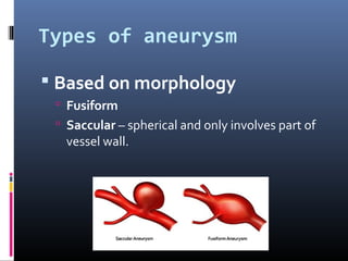Aneurysms | PPT