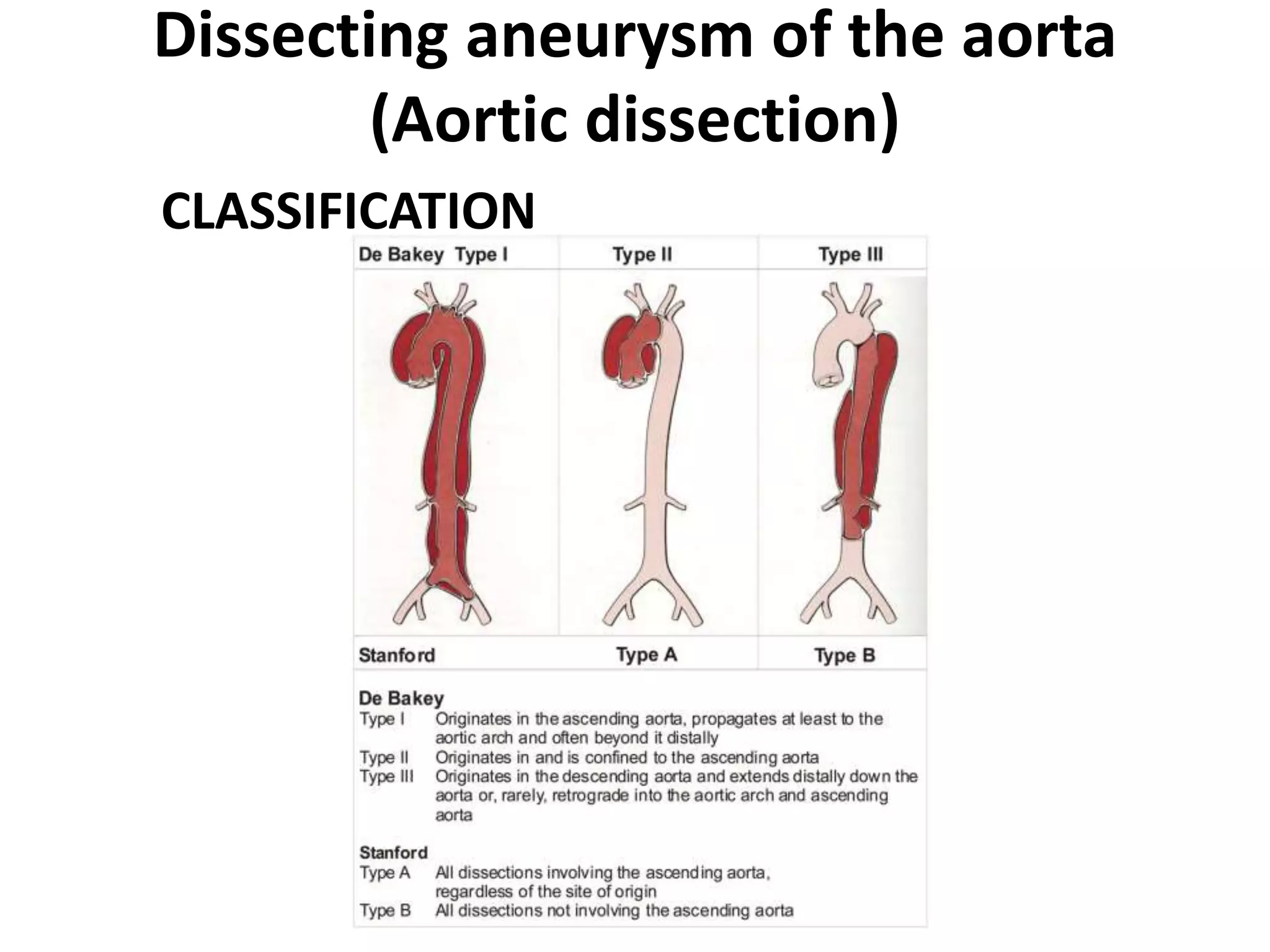 Aneurysms | PPTX